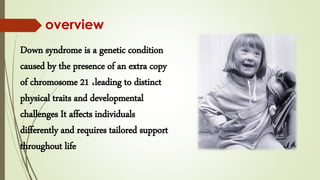down syndrome, Understanding Down Syndrome: A Genetic and Developmental ...