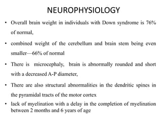 down syndrome 1.pptx