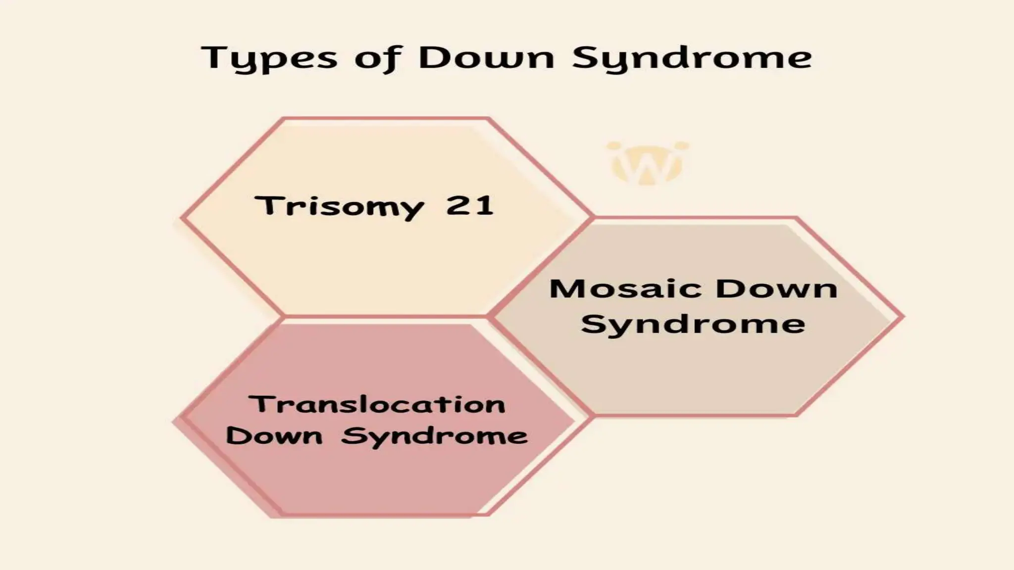 Down syndrome (2)[1].pptx pediatric lecture | PPT