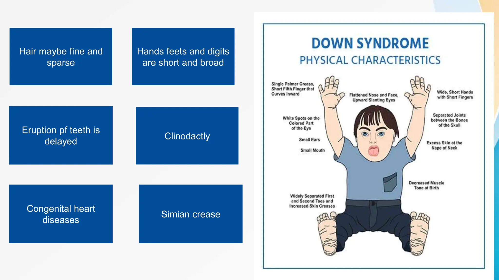 Down syndrome (2)[1].pptx pediatric lecture | PPT