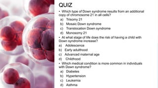 Down syndrome (2)[1].pptx pediatric lecture | PPTX