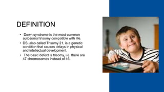 Down syndrome (2)[1].pptx pediatric lecture | PPTX