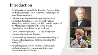 Down syndrome. Mechanism, Investigation, Treatment, Dermatoglyphic ...