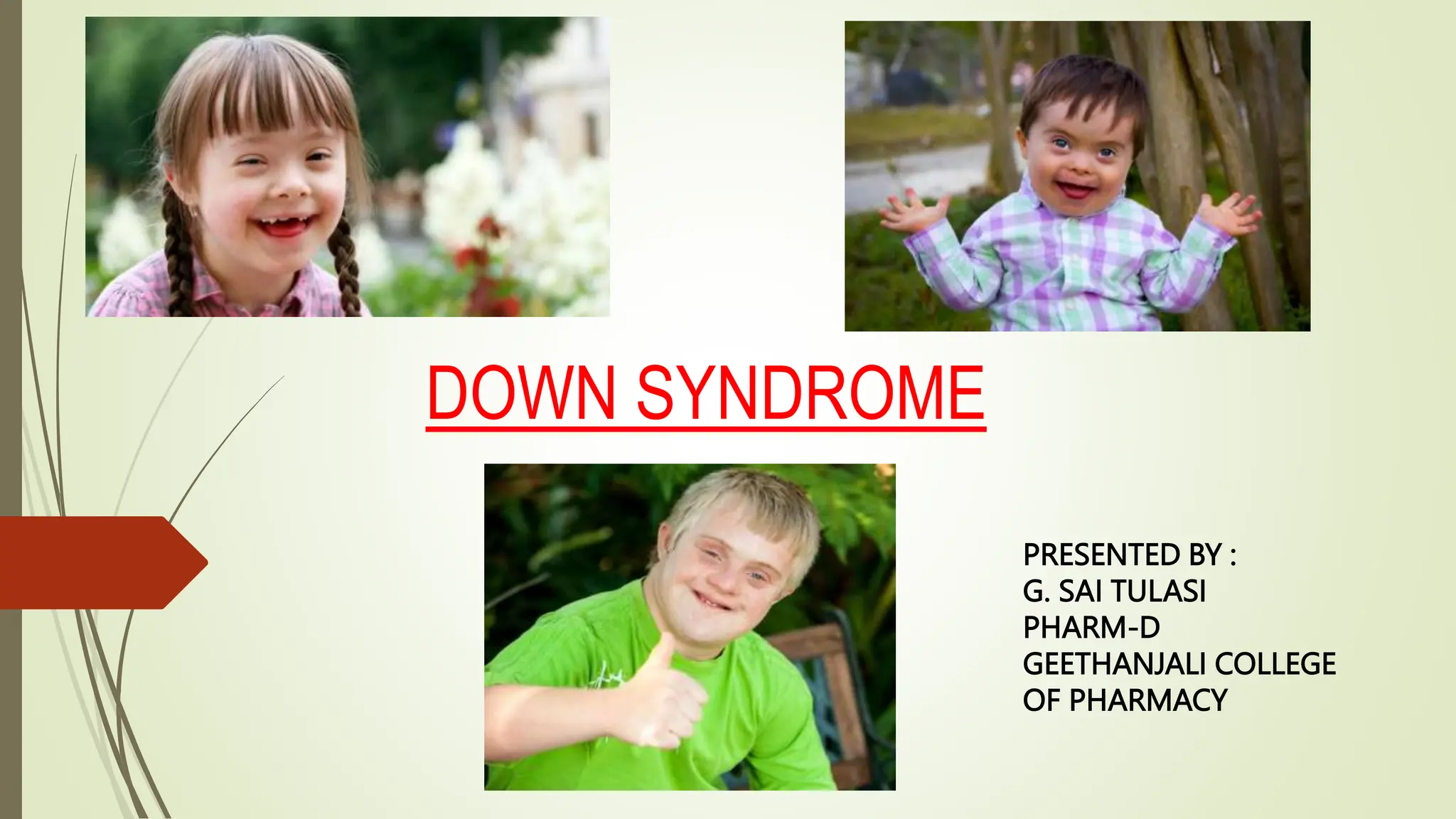DOWN SYNDROME: introduction, definition, types,etiology ...