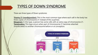 DOWN SYNDROME: introduction, definition, types,etiology ...