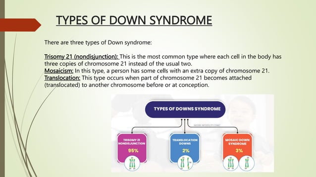 DOWN SYNDROME: introduction, definition, types,etiology ...