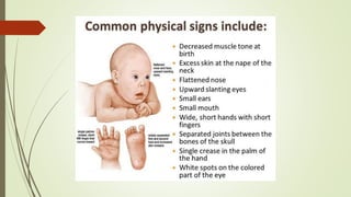 DOWN SYNDROME: introduction, definition, types,etiology ...