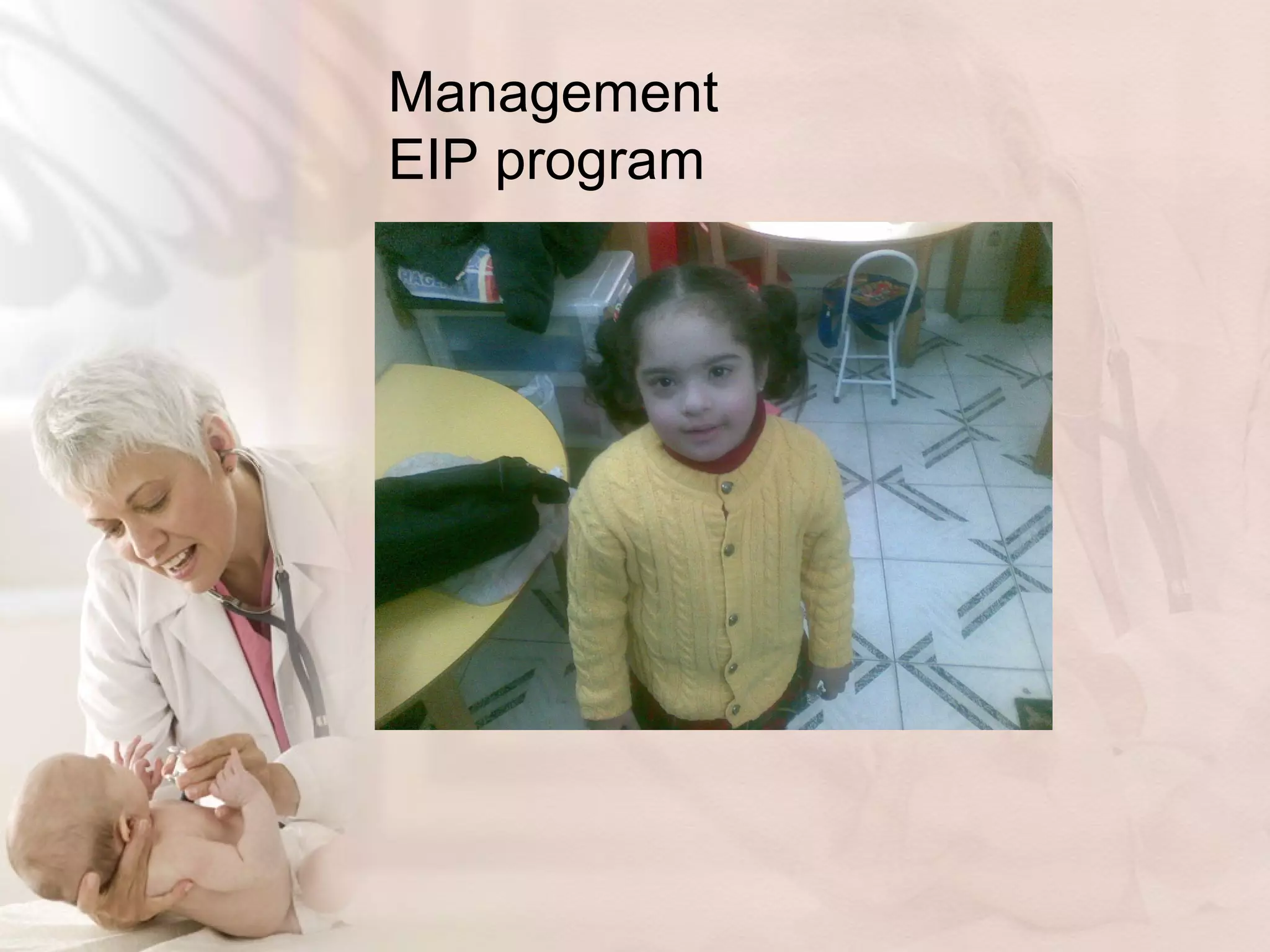 Down syndrome for PEDO | PPT