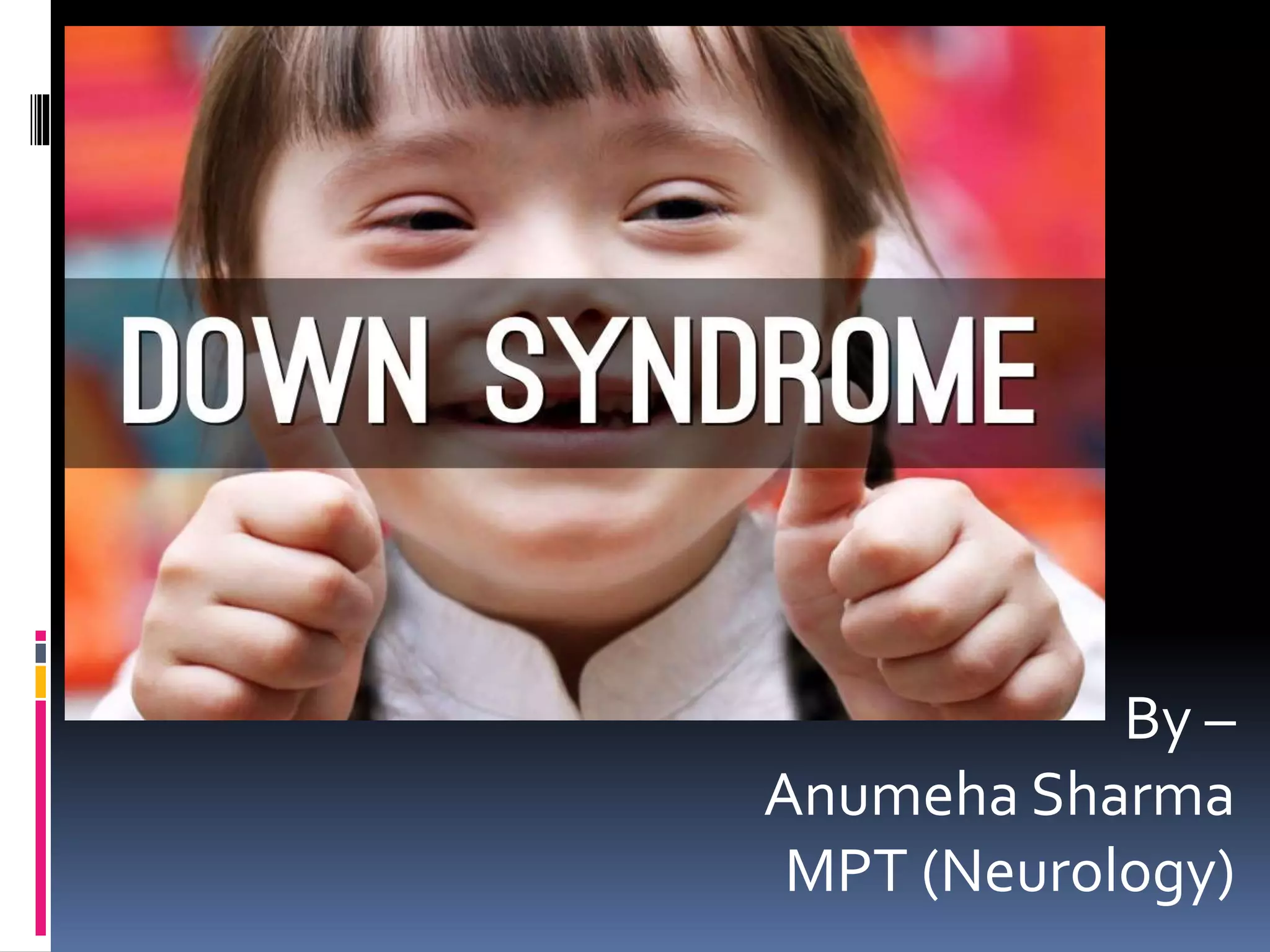 Down syndrome and Physiotherapy Management | PPTX