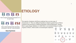 down syndrome Presentation. providing basic knowledge about down ...