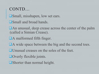 Down syndrome student copy.pptx