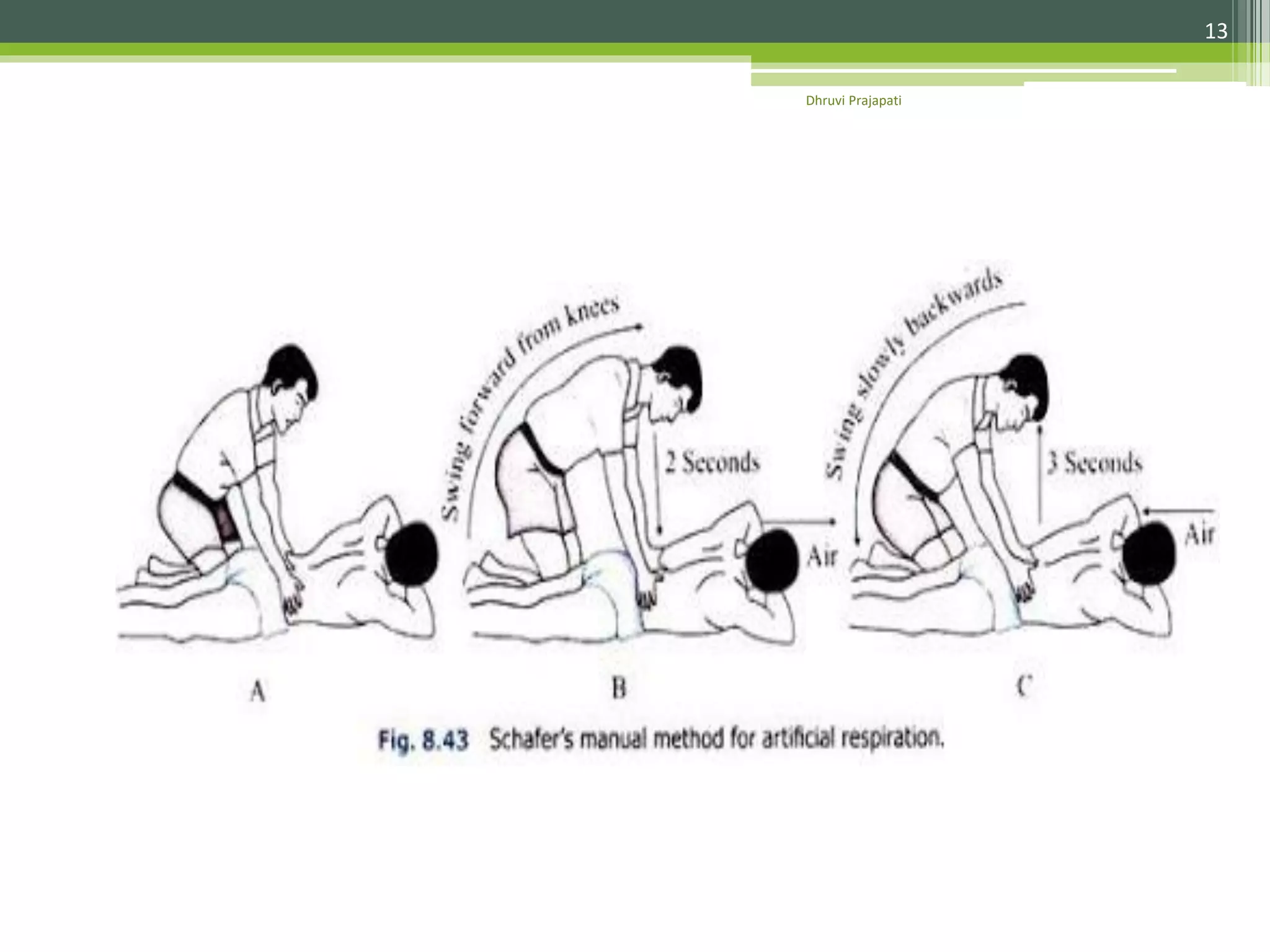 Artificial Respiration (Resuscitation method) | PDF