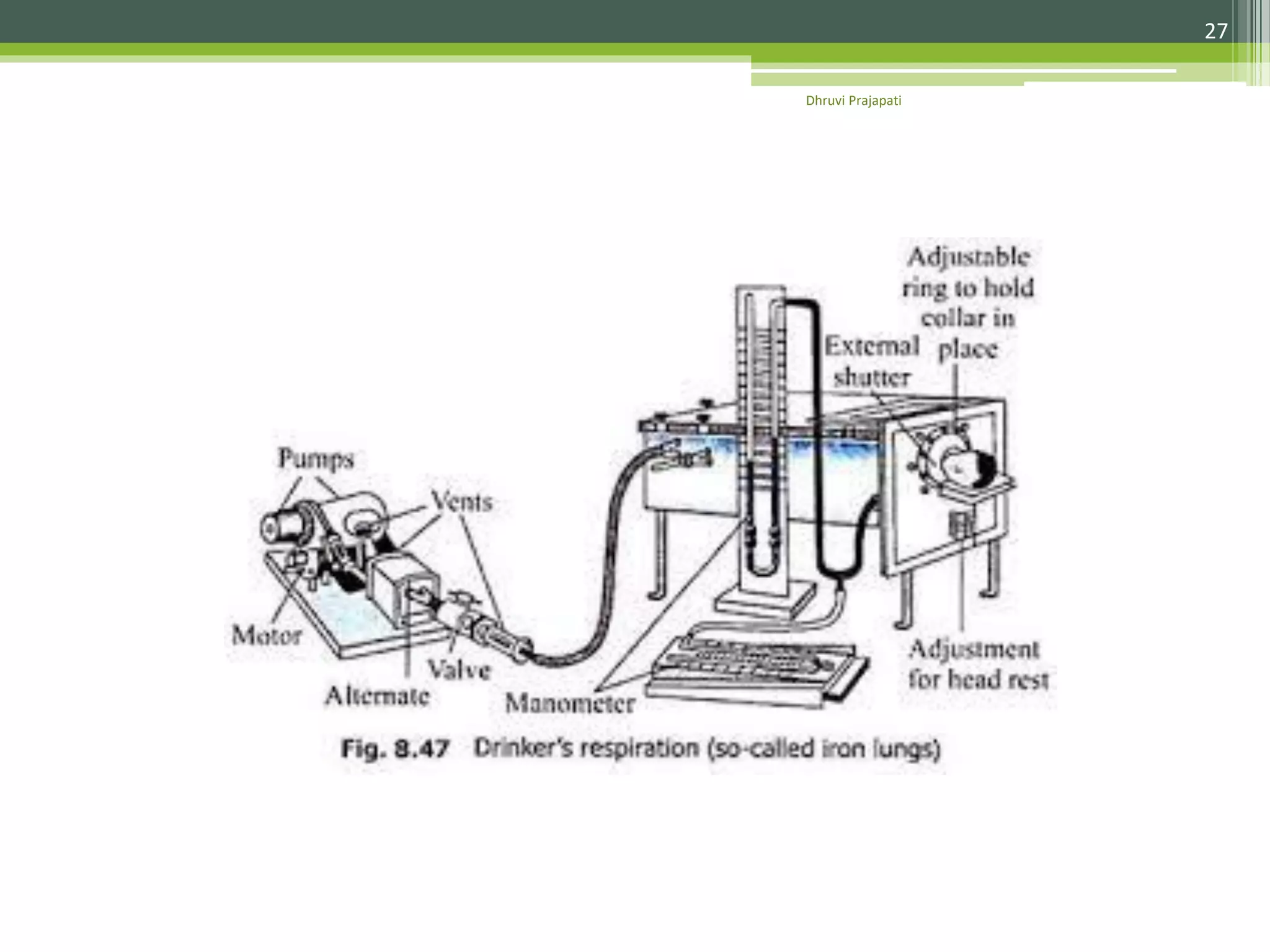 Artificial Respiration (Resuscitation method) | PDF