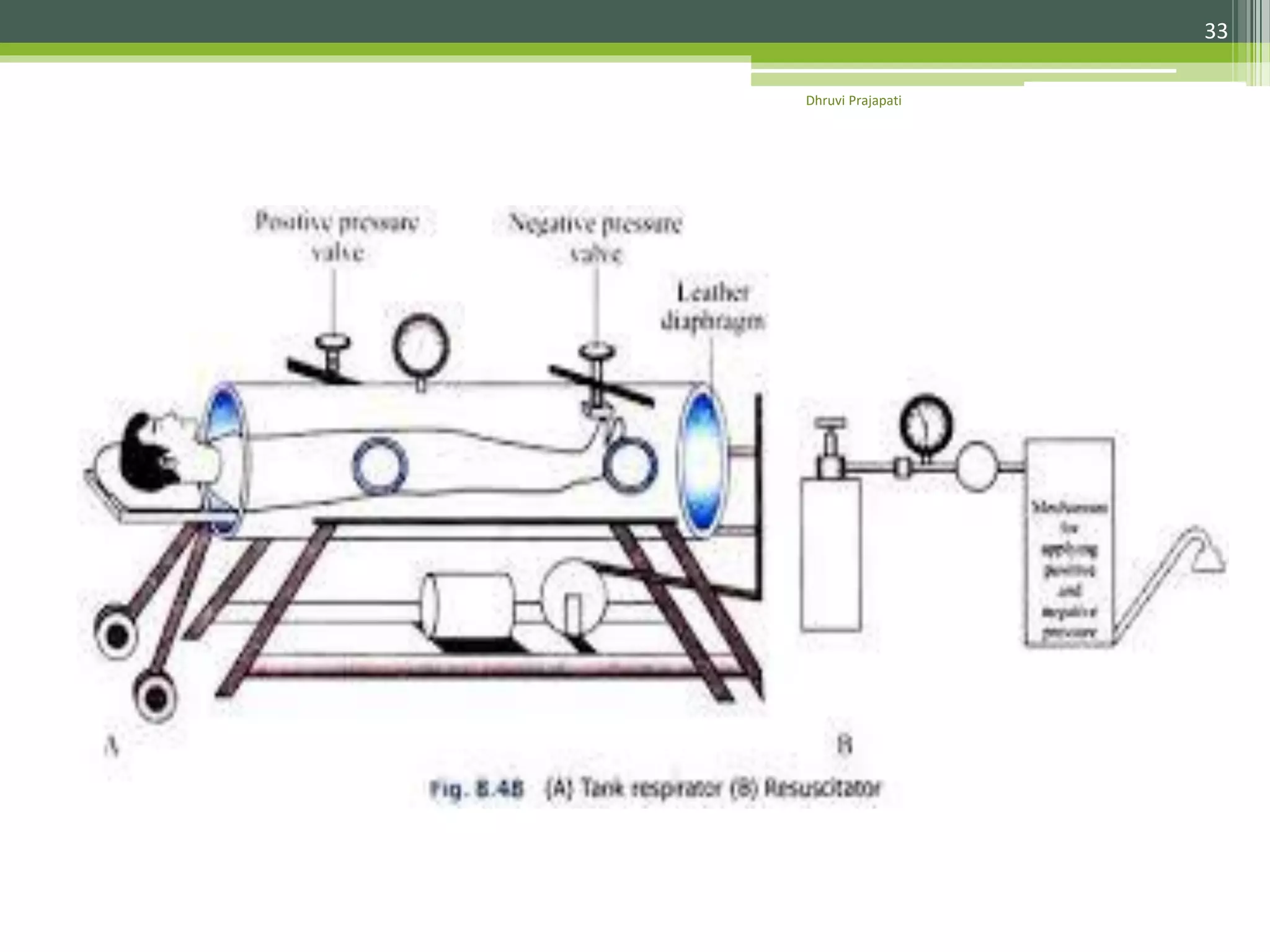 Artificial Respiration (Resuscitation method) | PDF