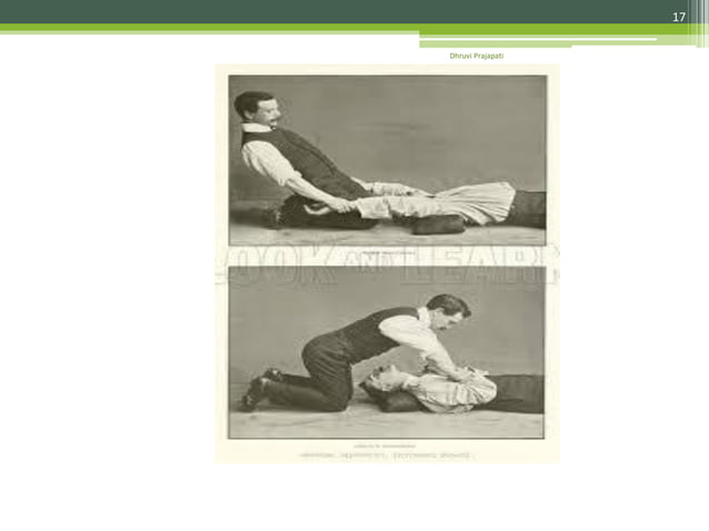 Artificial Respiration (Resuscitation method) | PDF | First Aid | Injuries