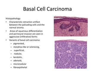 Basal cell carcinoma presented by Dr.Varughese. | PPTX
