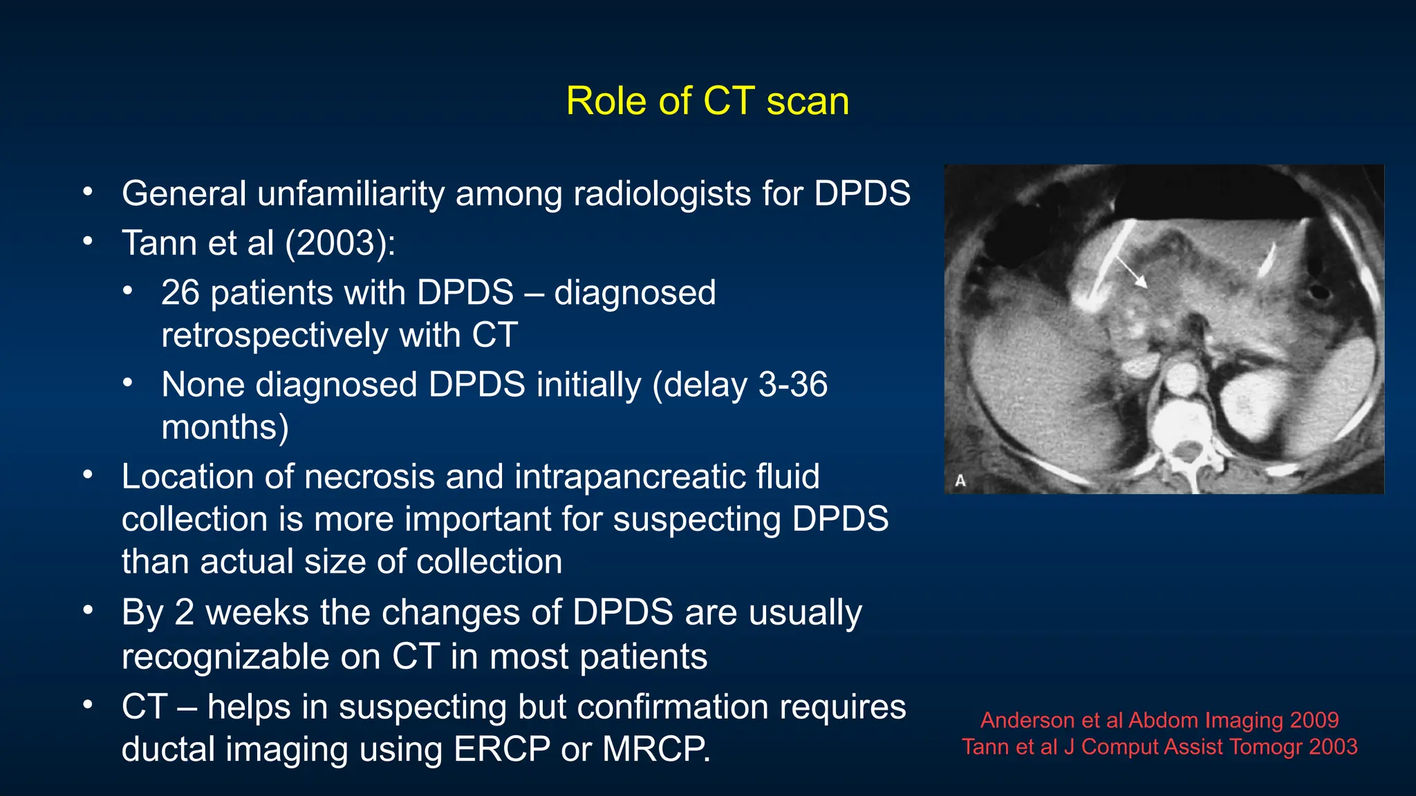 Disconnected pancreatic duct syndrome.pptx
