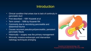 Disconnected pancreatic duct syndrome.pptx