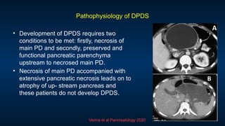 Disconnected pancreatic duct syndrome.pptx