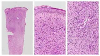 DERMPATH EXAM FOR PRACTICE MOVING EXAM.pptx