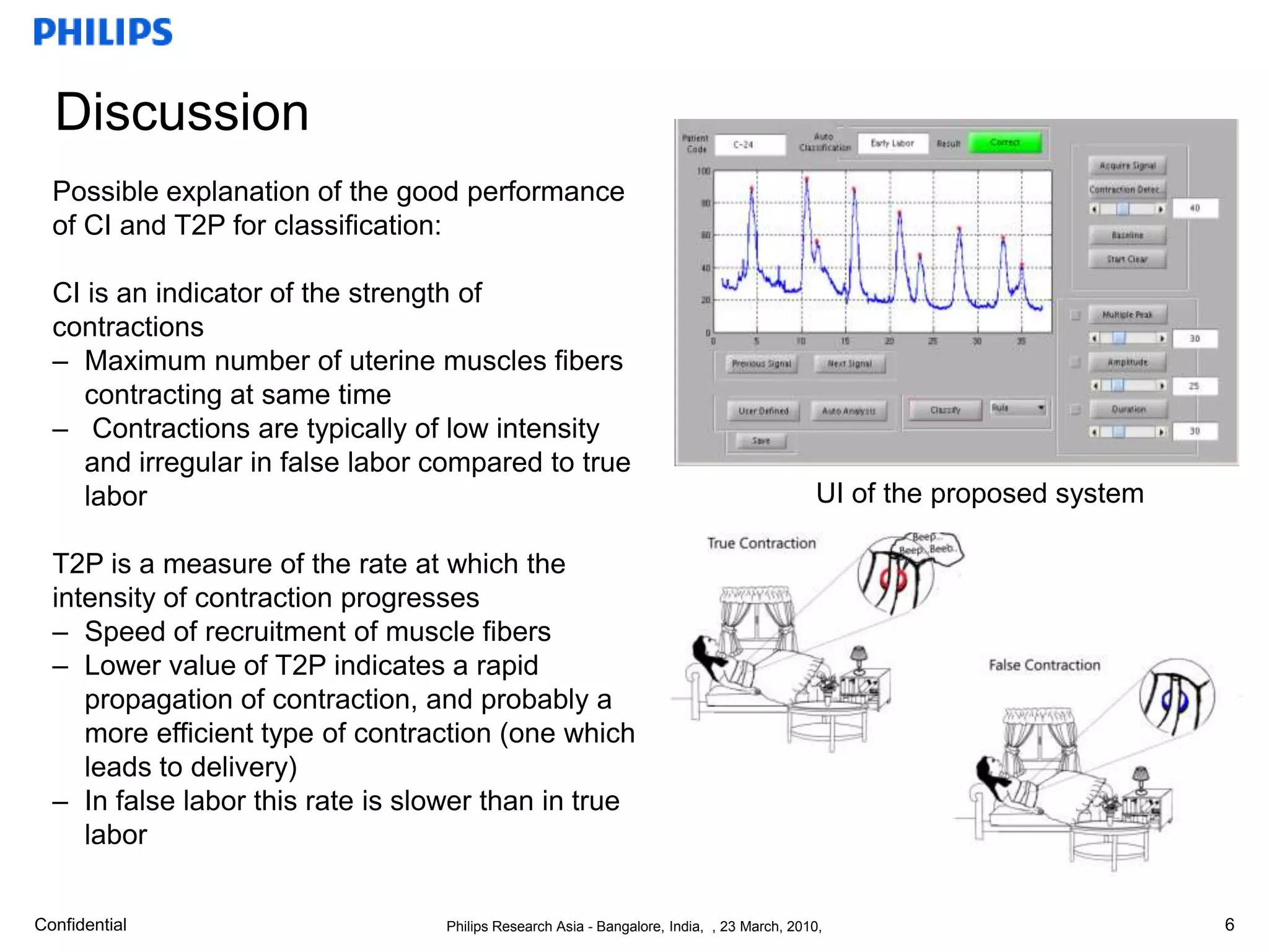 D:\Philips\Pregnancy Monitoring\Trainees\Ctg\Ama Ieee\Automated Uterine ...