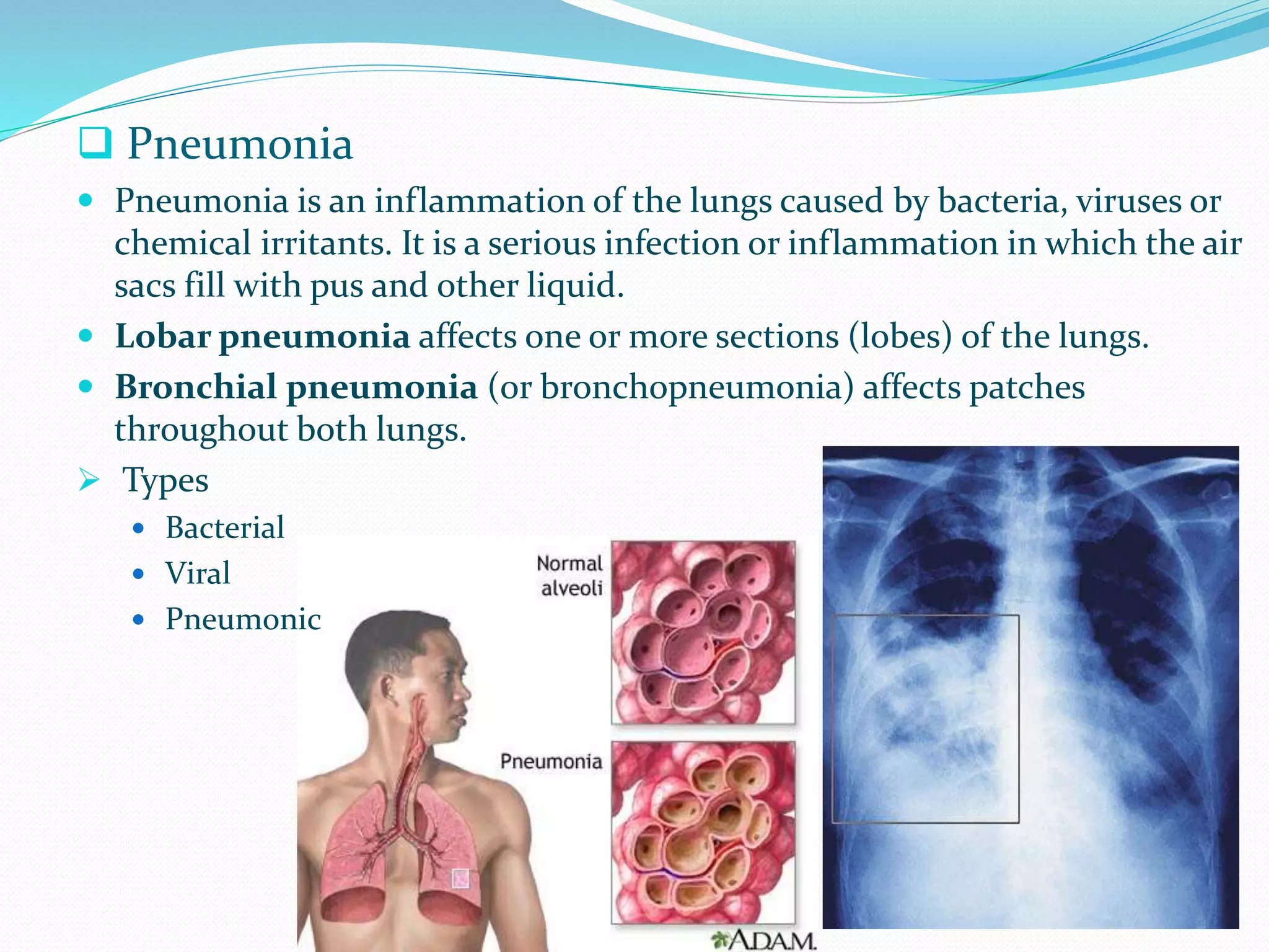 Physiology of respiration | PPTX