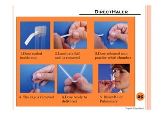Dry powder Inhaler Device- Yogesh Chaudhari | PDF