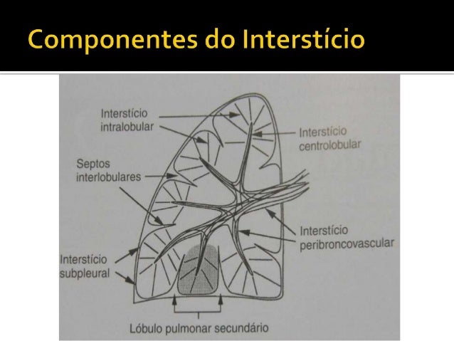 Doenças Pulmonares Intersticiais