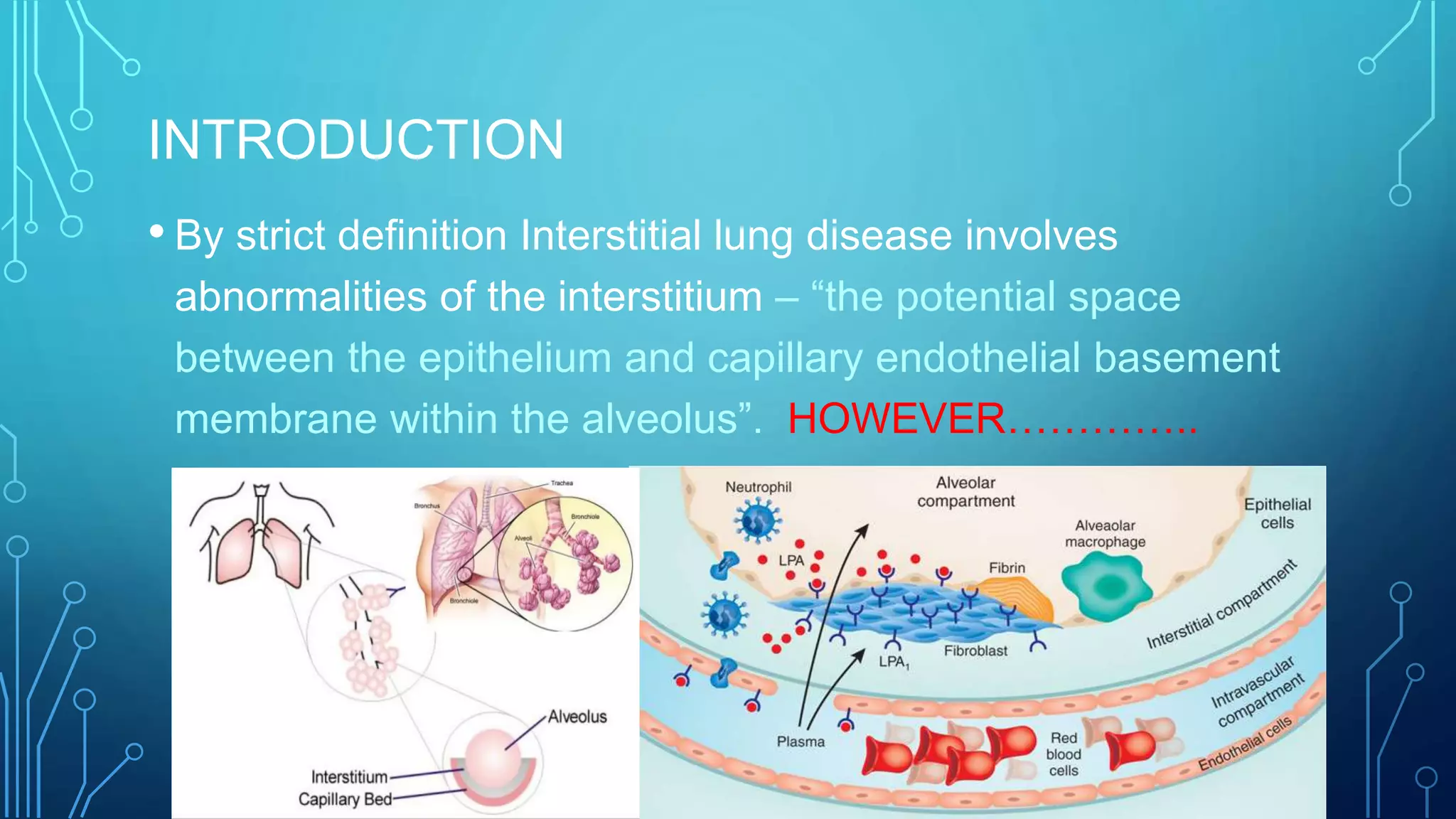 Introduction to Interstitial Lung Disease(ILD) or Diffuse Parenchymal ...