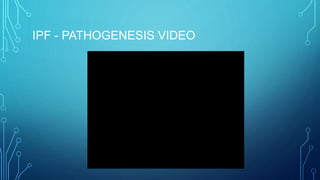 Introduction to Interstitial Lung Disease(ILD) or Diffuse Parenchymal ...