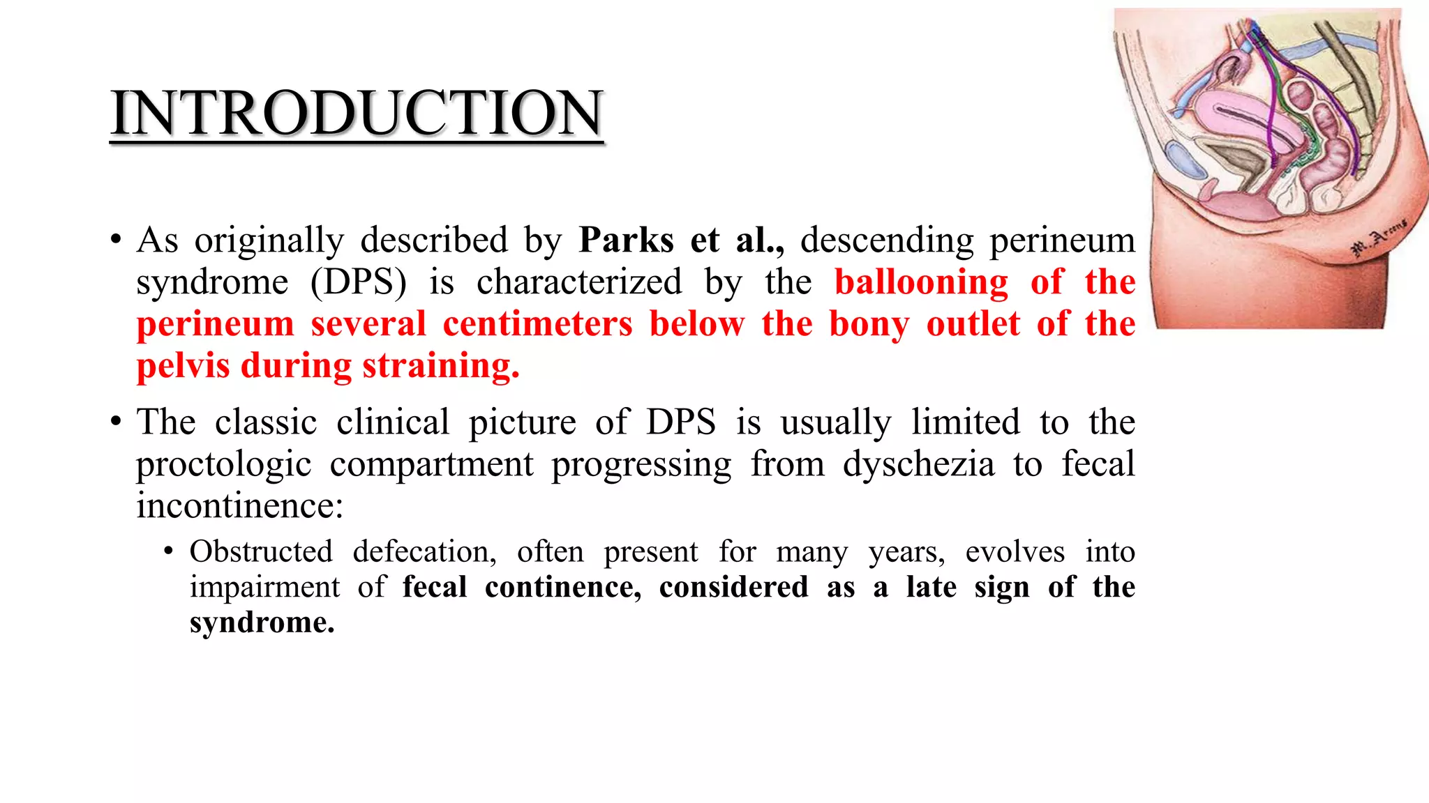 DESCENDING PERINEUM SYNDROME | PPTX