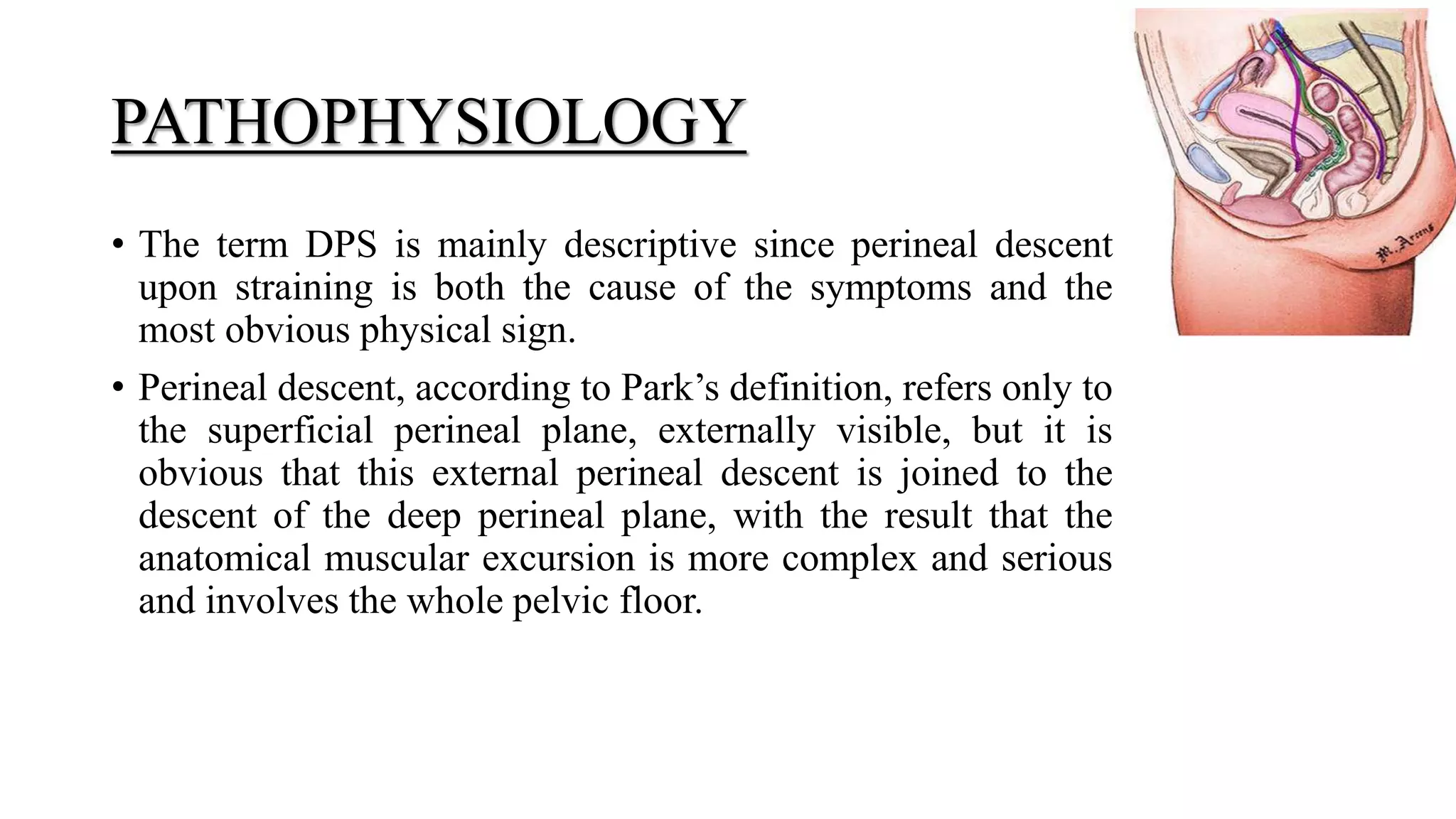 DESCENDING PERINEUM SYNDROME | PPTX