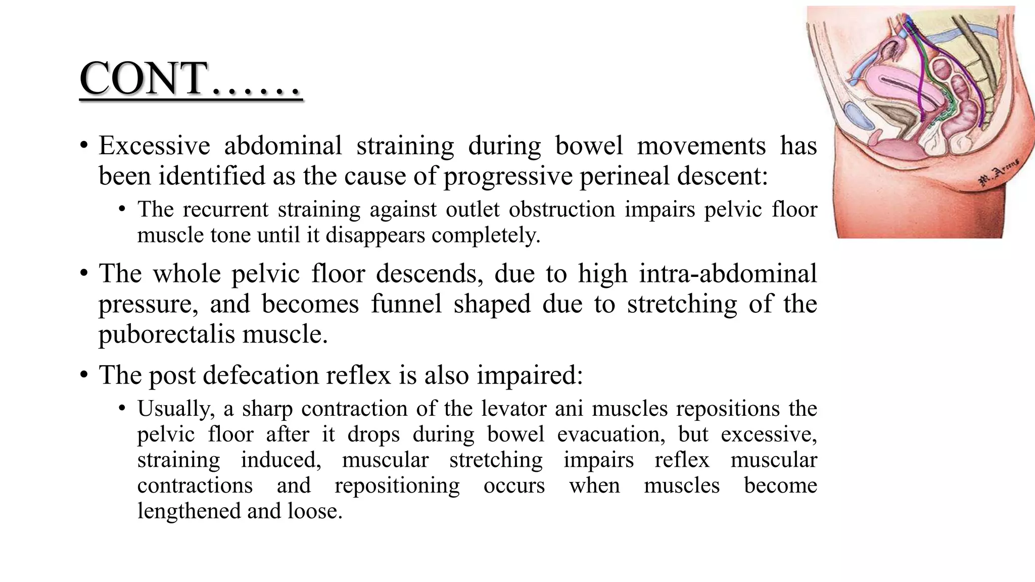 DESCENDING PERINEUM SYNDROME | PPTX