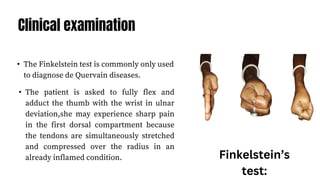 Dequervain's tenosynovitis splint case presentation | PPTX