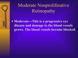 Diabetic Retinopathy | PPT