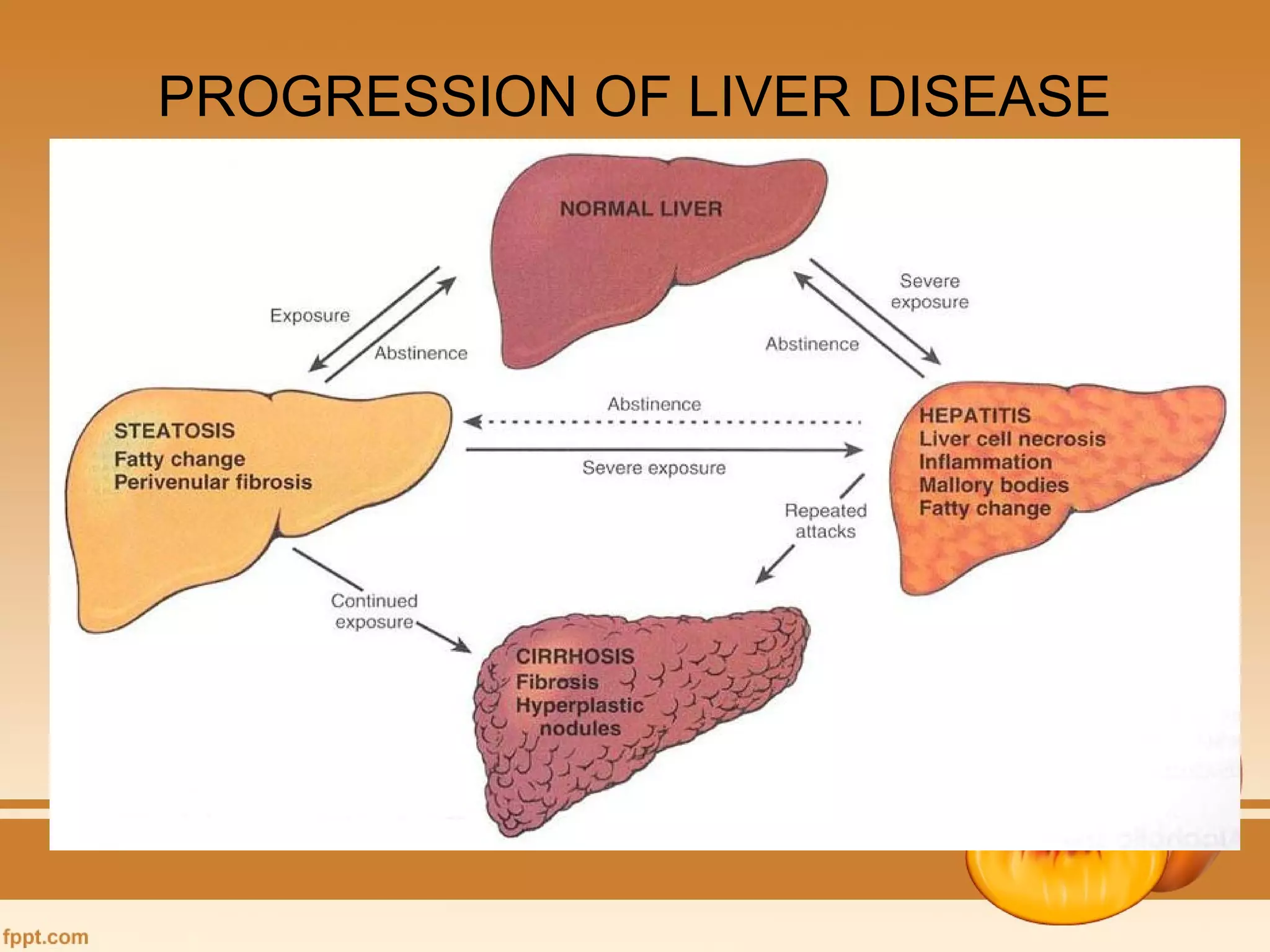 NUTRITION IN LIVER DISEASE | PPT