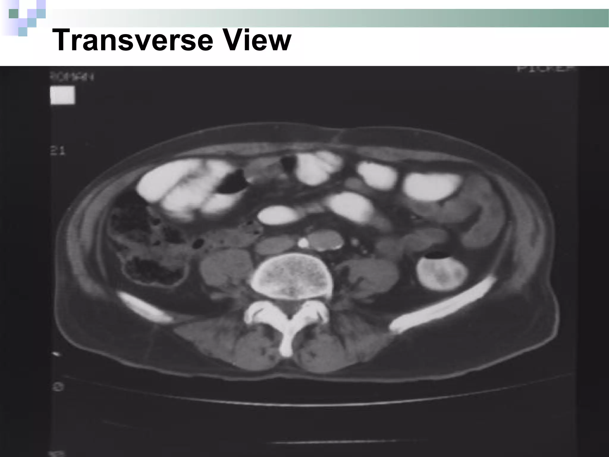 Introduction to Anatomy | PPT