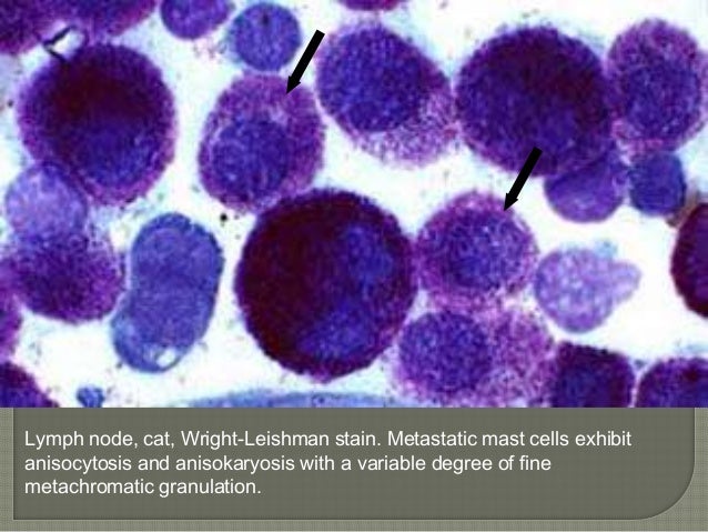 Dr.vishal mastocytoma