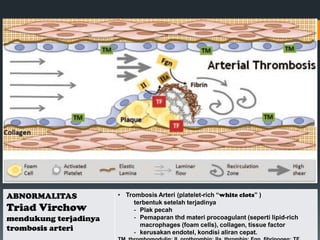 HYPOFIBRINOLYSIS A Risk Factor for ARTERIAL THROMBOSIS AND VENOUS ...