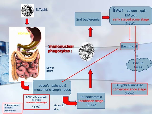Correlation liver disfunction and infection disease (dengue typhoid ...