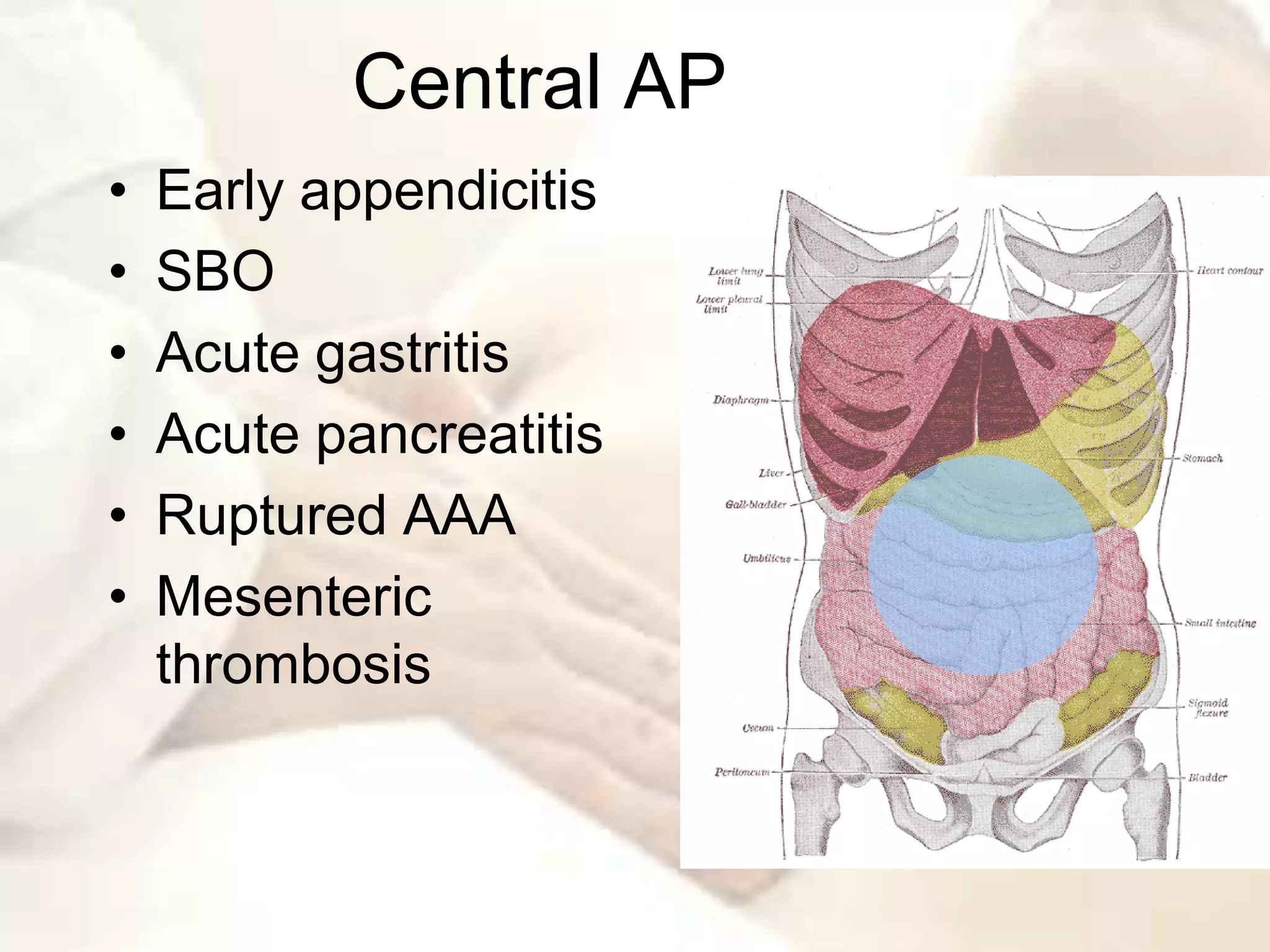Diagnosa dan Manajemen Nyeri Abdomen Akut | PPSX