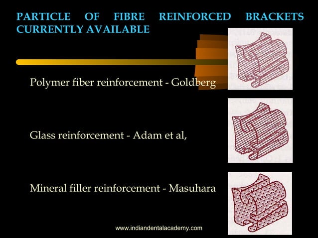 tooth coloured-orthodontic materials /certified fixed orthodontic ...