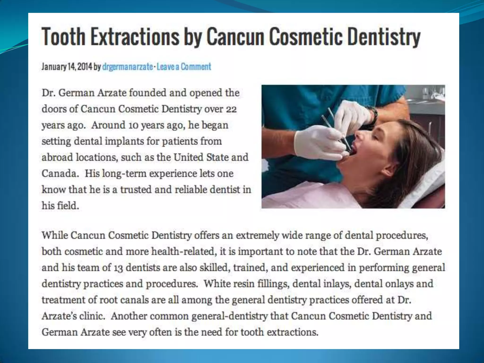 Tooth Extraction by Dr. German Arzate | PPT