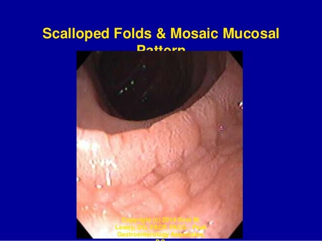 Celiac Disease, Gluten Sensitivity_Dr. Scot Lewey