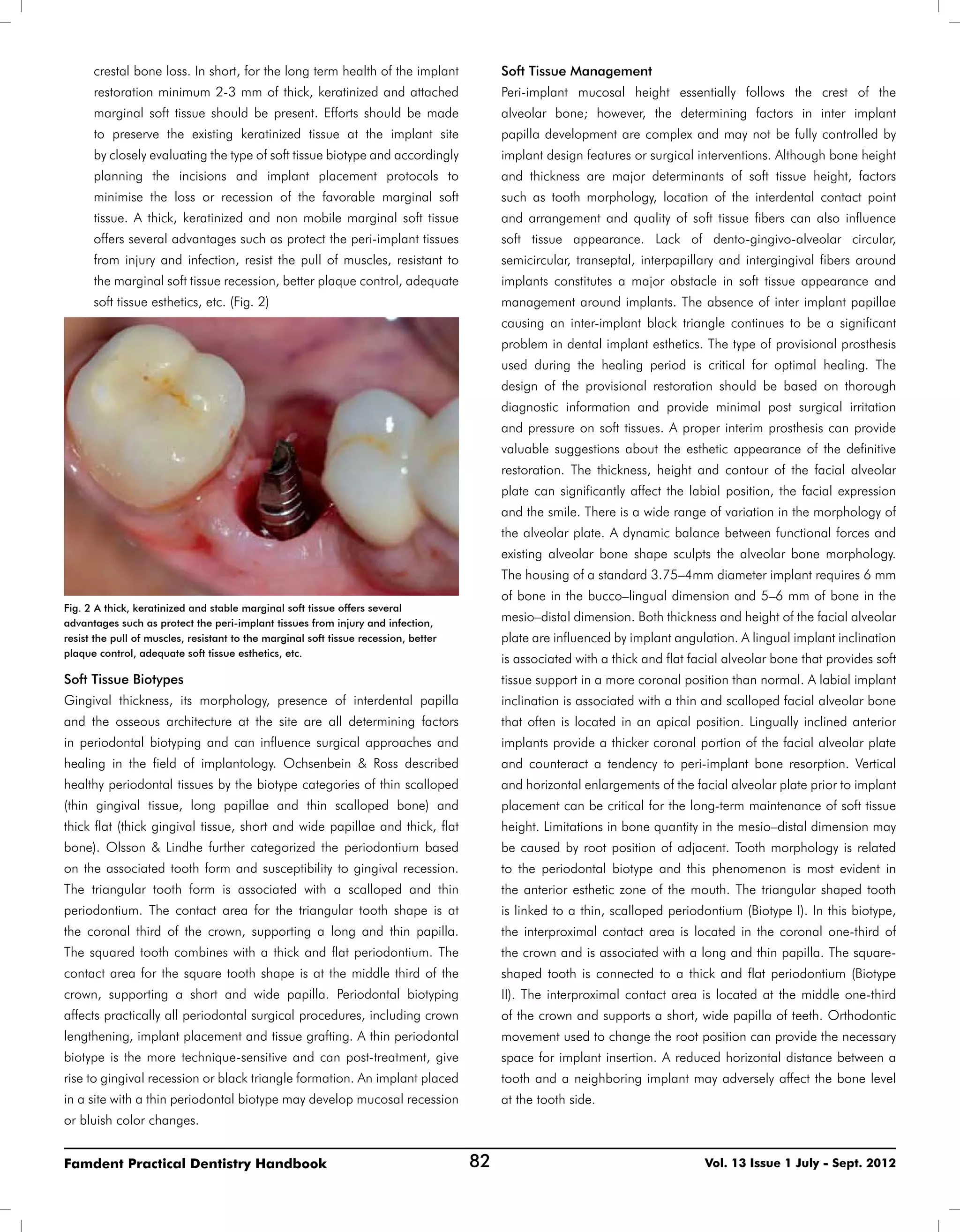 Management of soft tissue aesthetics in implant- D | PDF