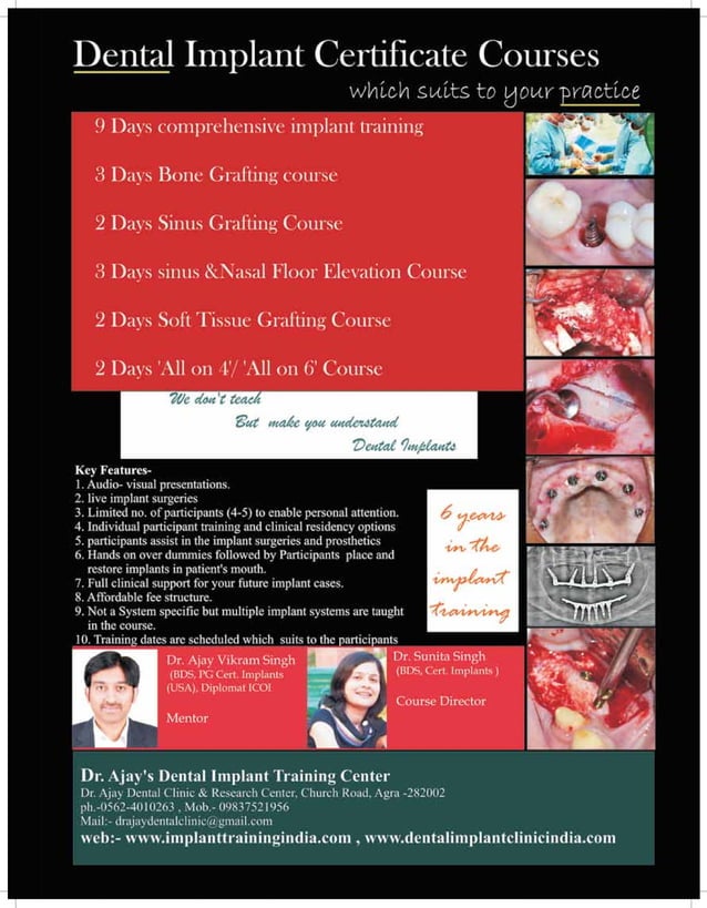 soft tissue management with implant Dr. Ajay Vikram singh | PDF