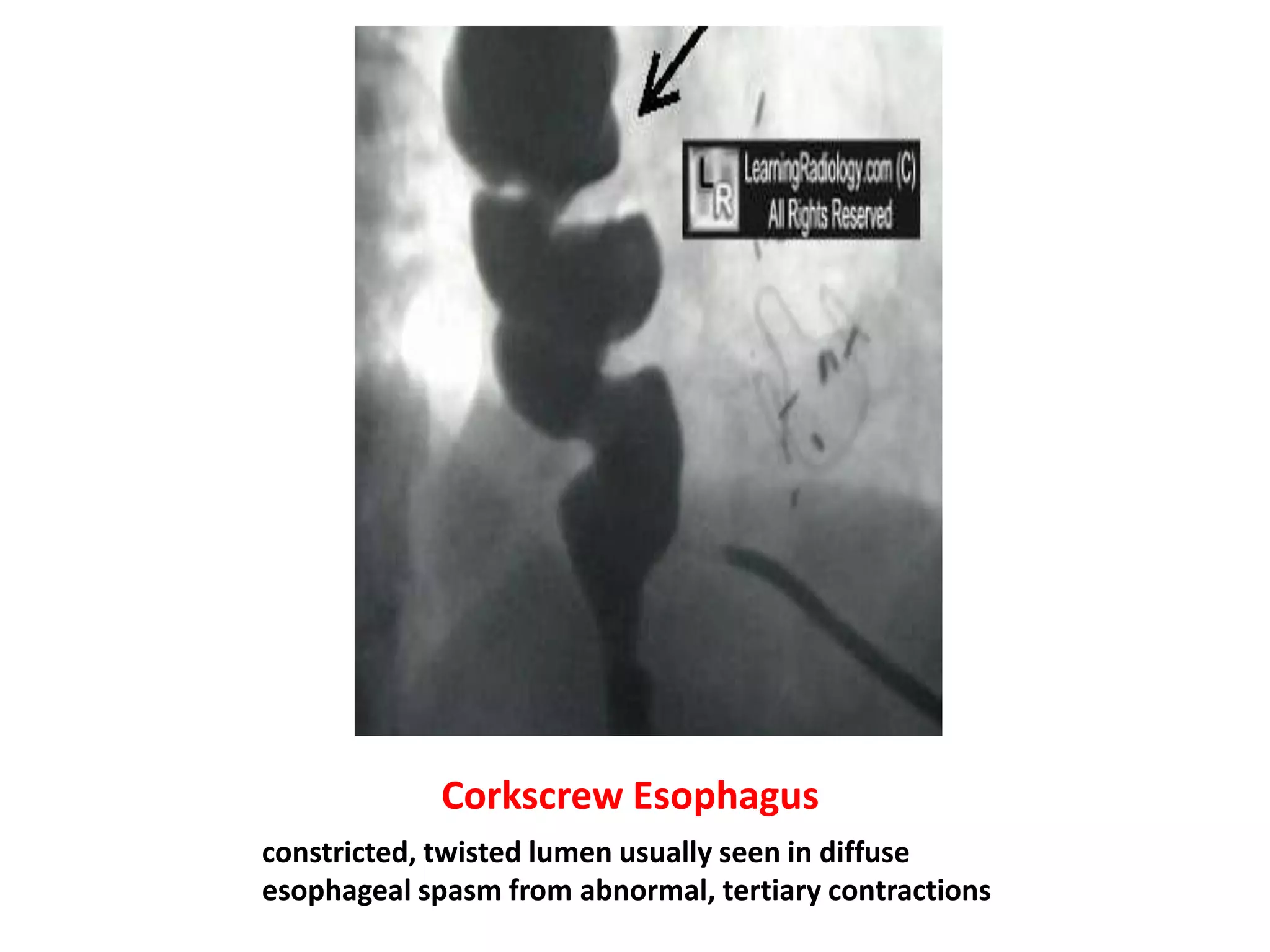 Dr.laith notes about common radiological signs | PPTX