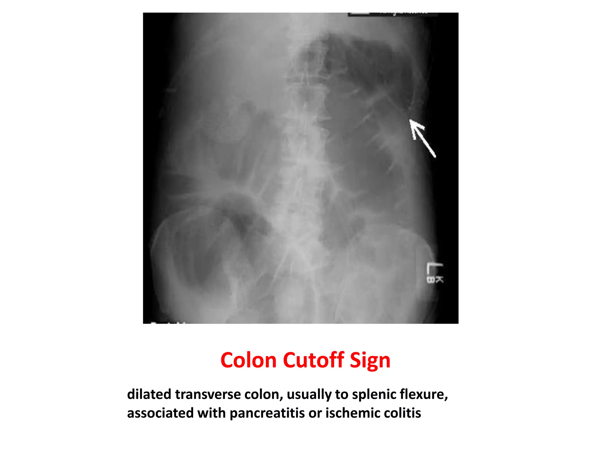 Dr.laith notes about common radiological signs | PPTX