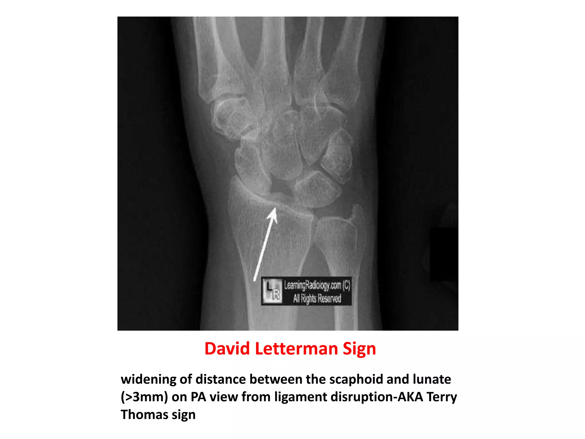 Dr.laith notes about common radiological signs | PPTX