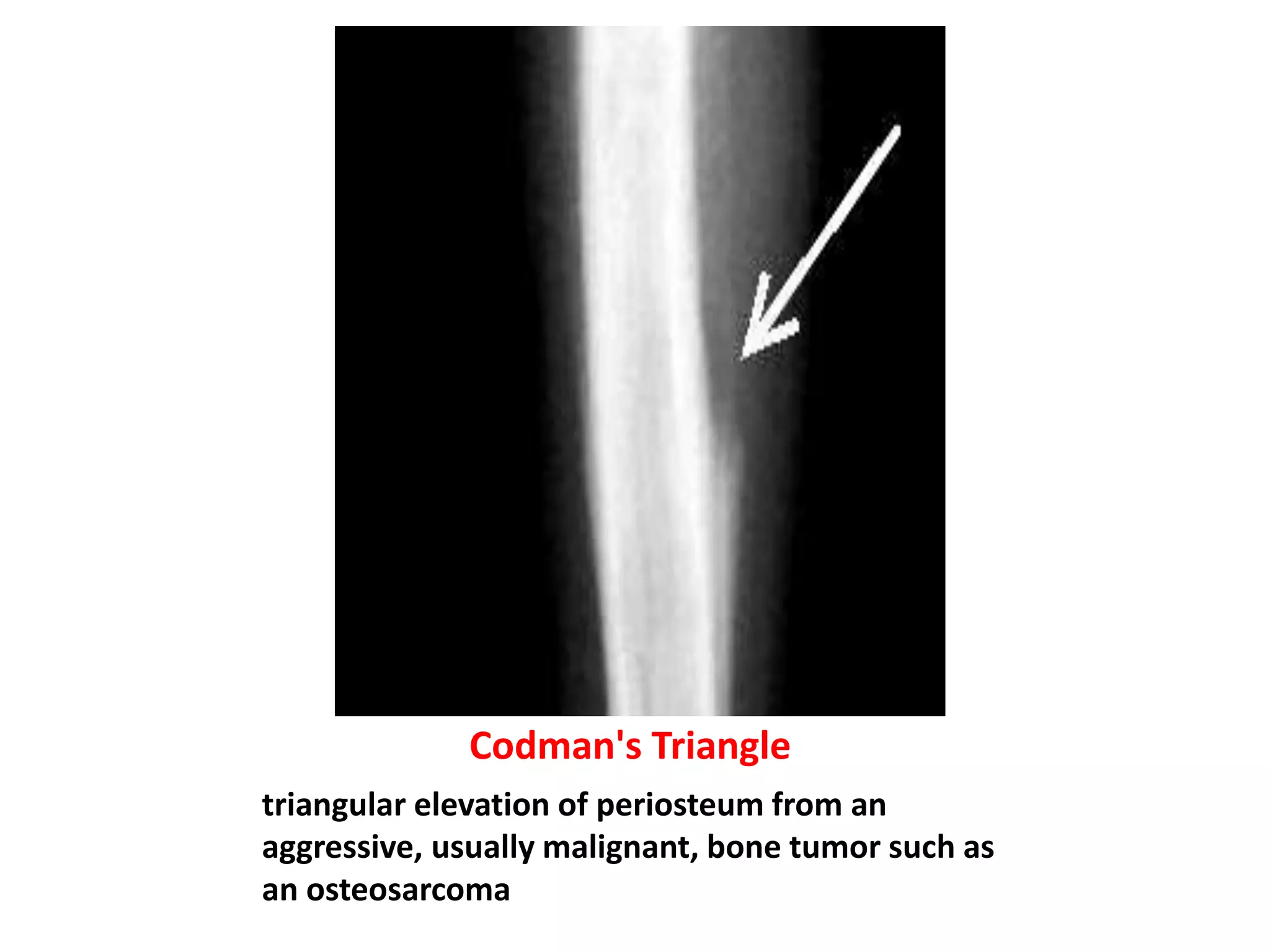 Dr.laith notes about common radiological signs | PPTX